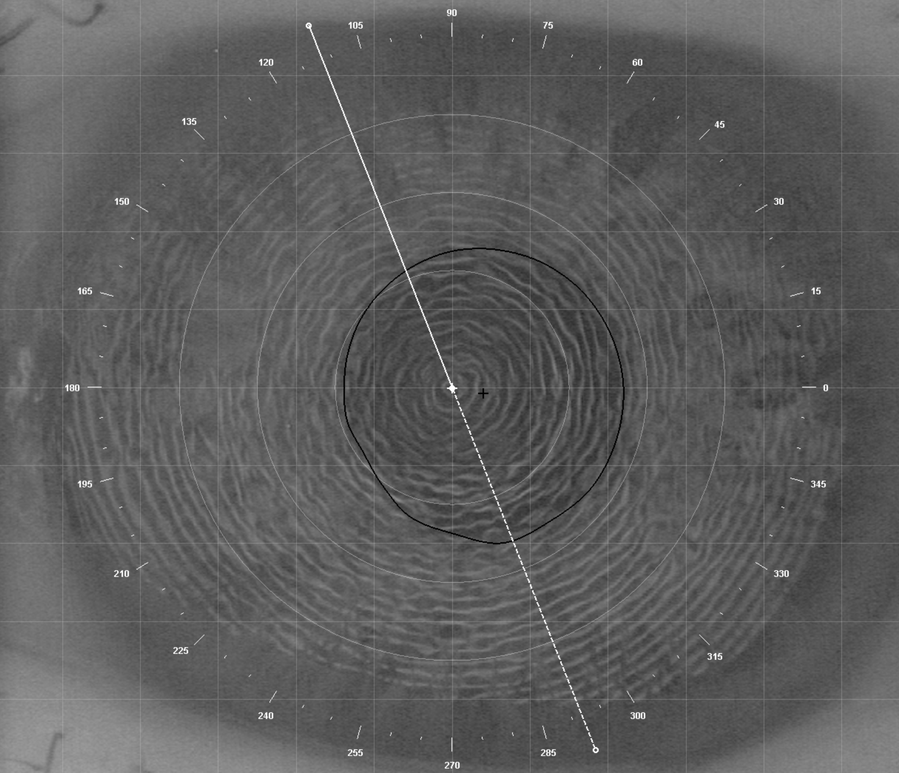 Dry Eye & Ocular Surface Evaluation — Ophthalmic Clinical Trials