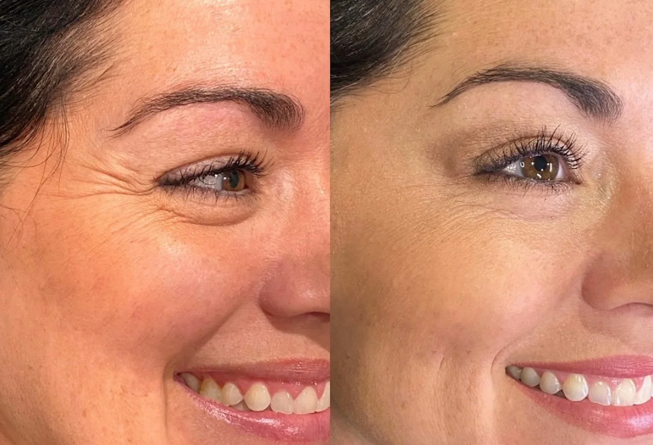 Services 1 — Sara Marie Facial Aesthetics