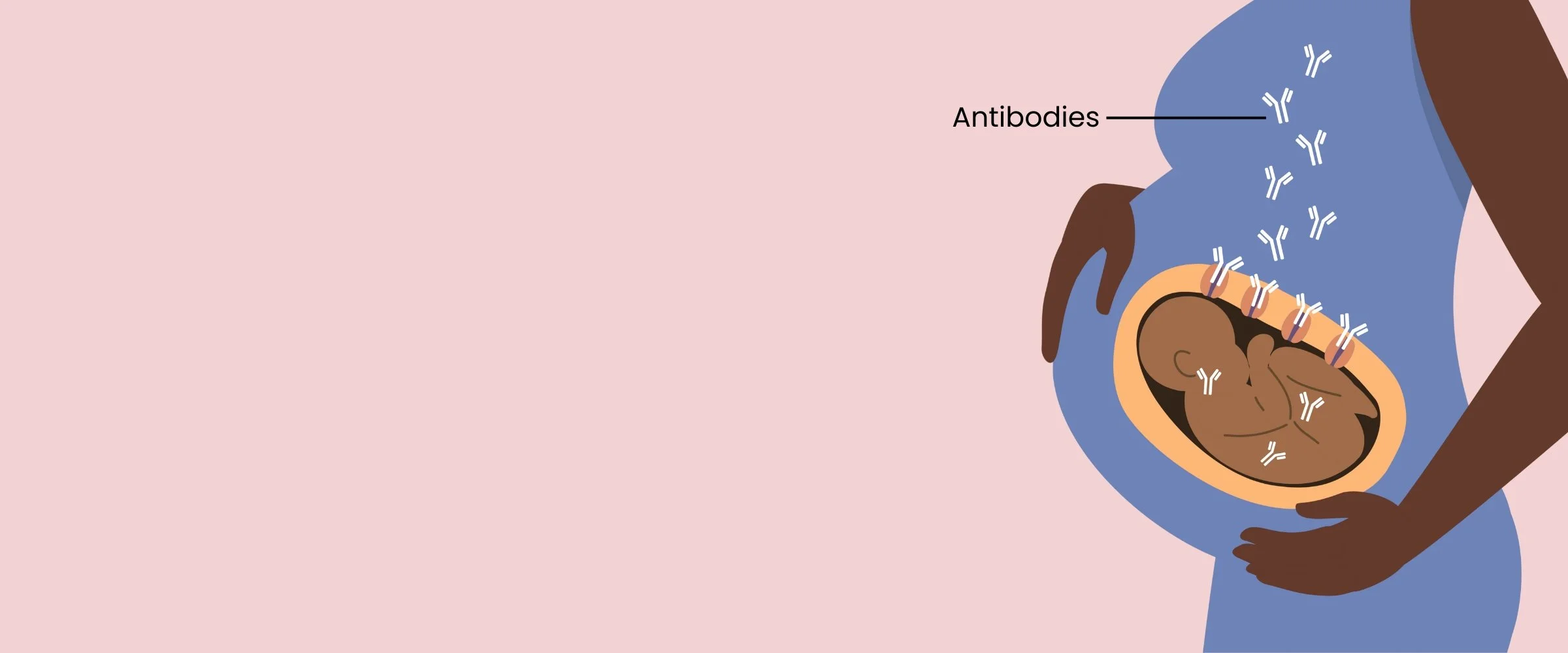 Influenza Vaccination in Pregnancy — Vaccines in Pregnancy Canada