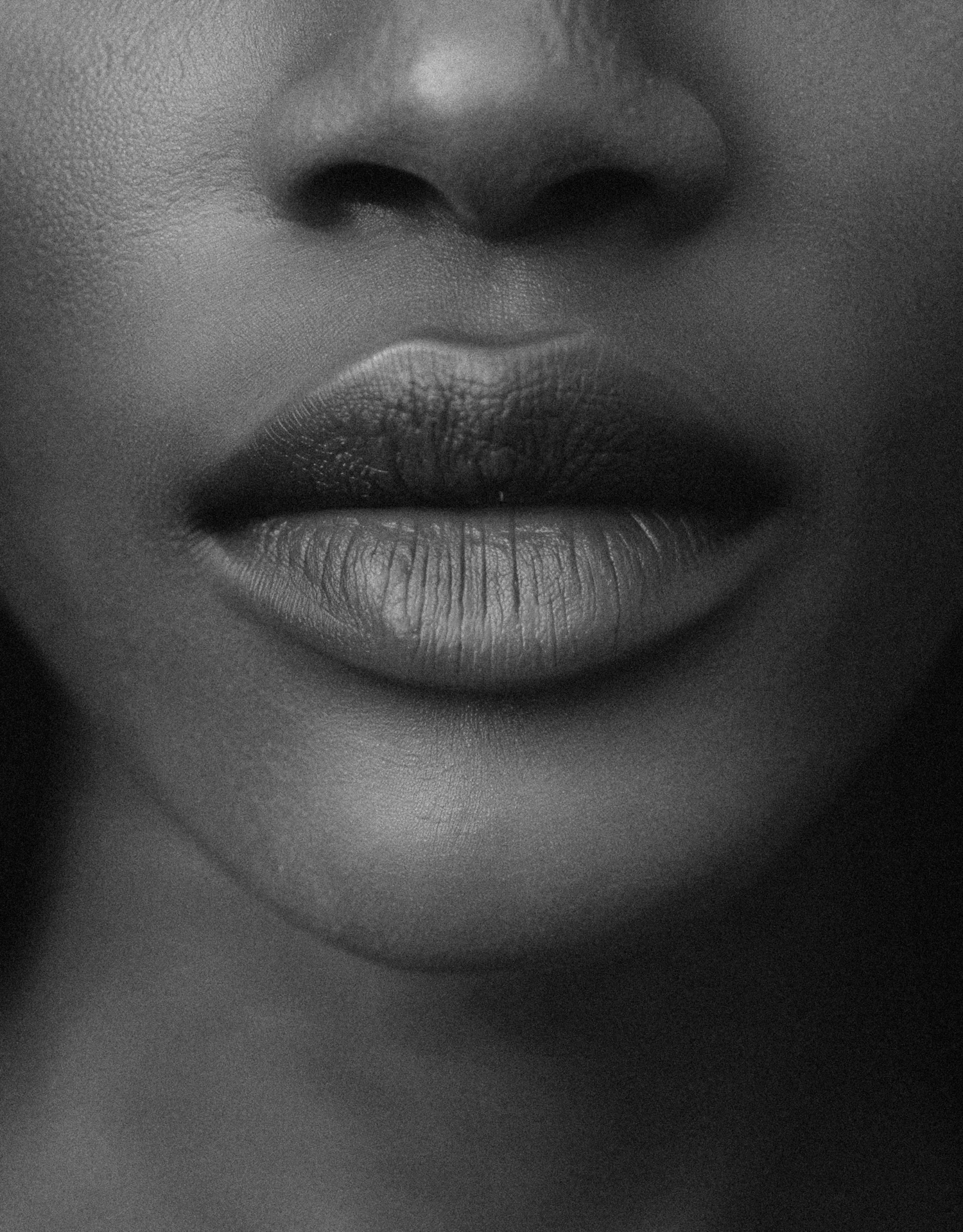 Lip Filler in Edina & Minneapolis, Minnesota — Pure Lux Medspa