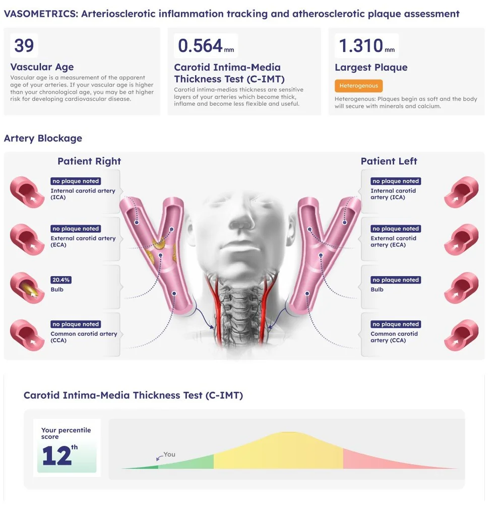 CureScreen + CIMT — The CureCenter