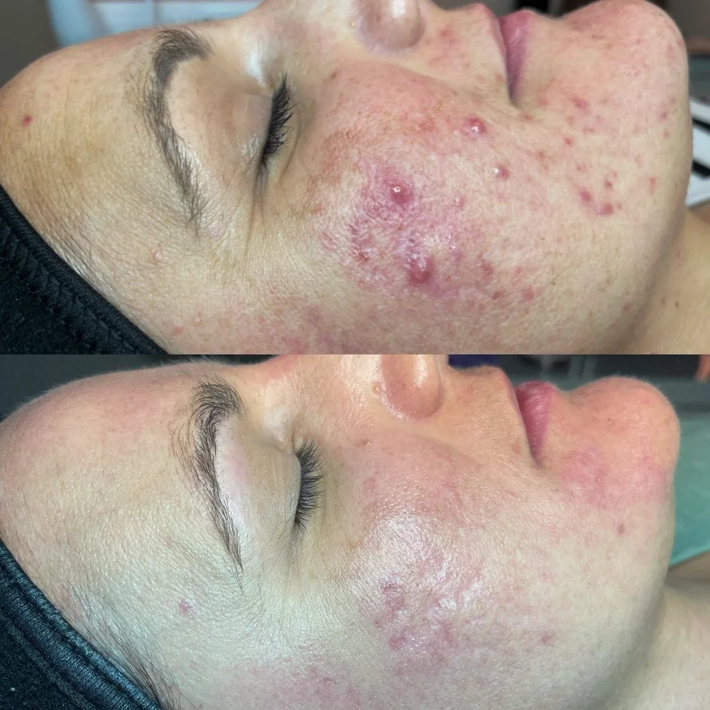 Gallery — The Skin Studio by Zo