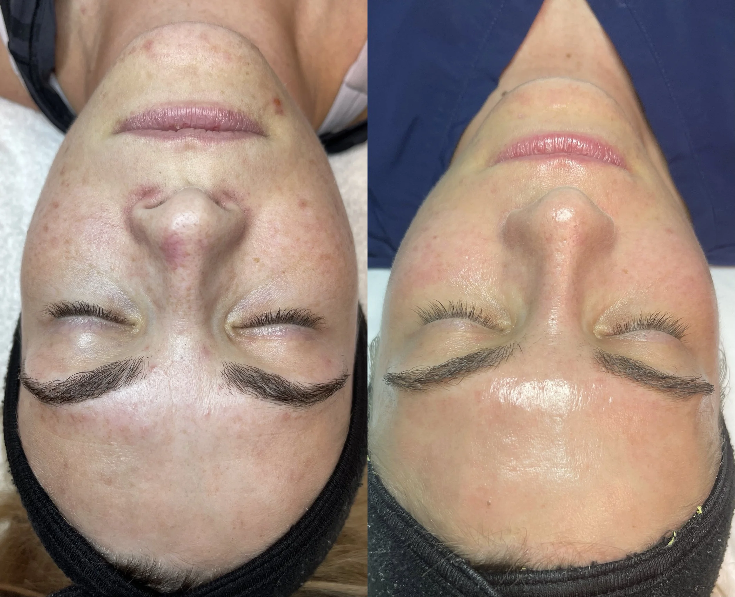 Services — The Skin Studio by Zo