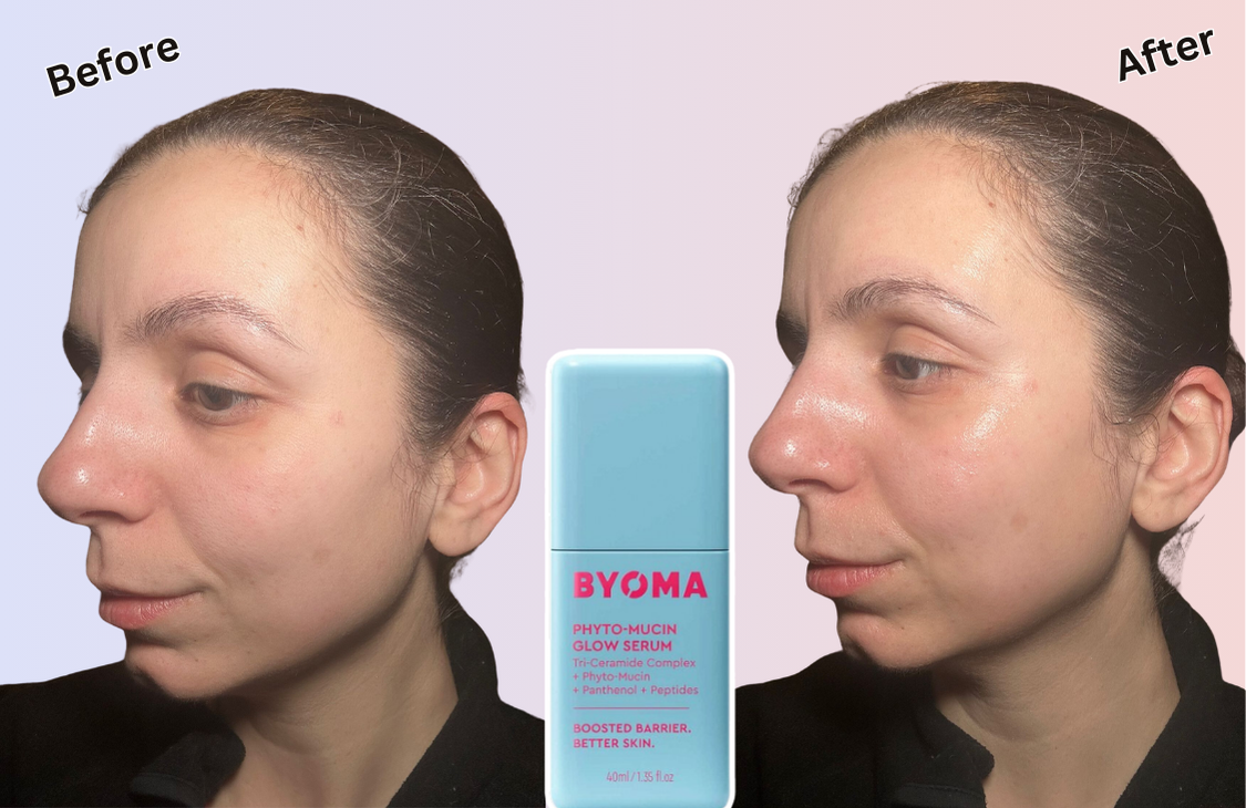 Byoma Phyto Mucin Glow Serum | Pros and Cons — Alexa Skin