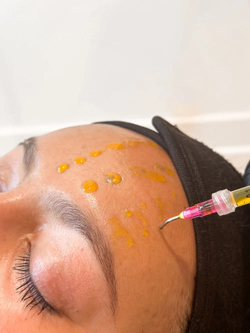 BioRe Peel — Habit Med Spa + Facial Bar