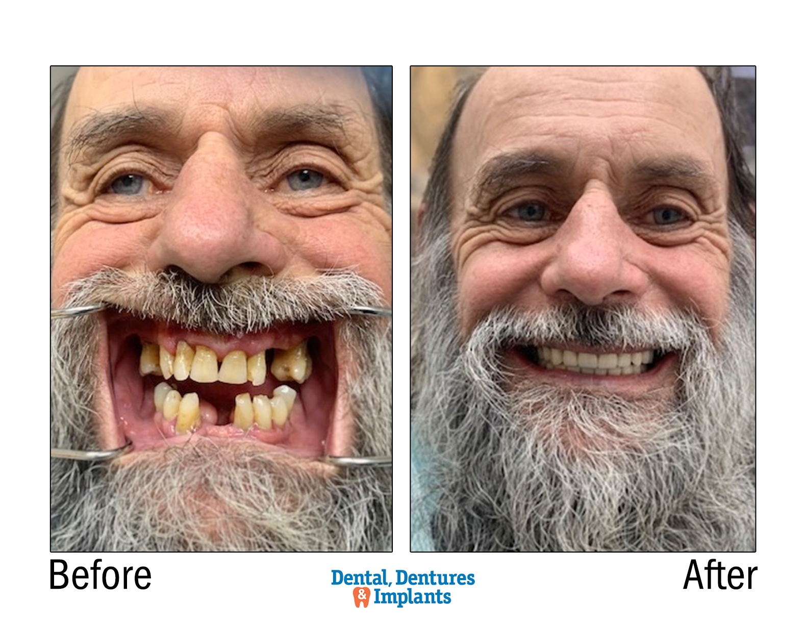 Faber, Dental Dentures Implants South Carolina