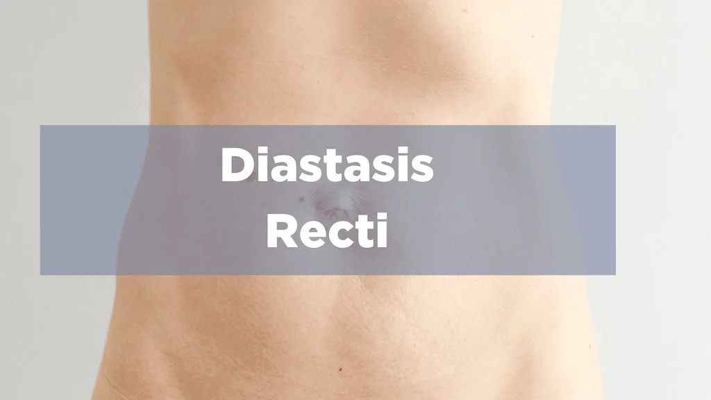 Diastasis Recti — FemFirstHealth