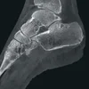 Ziehm Mobile C-arms — Progressive Medical Corp.
