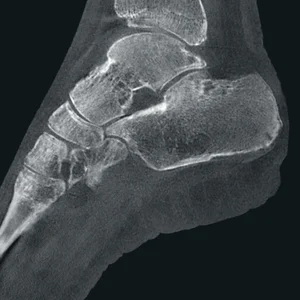 Ziehm Mobile C-arms — Progressive Medical Corp.