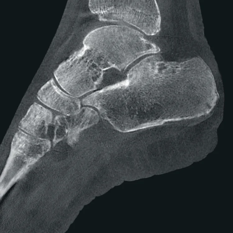 Ziehm Mobile C-arms — Progressive Medical Corp.