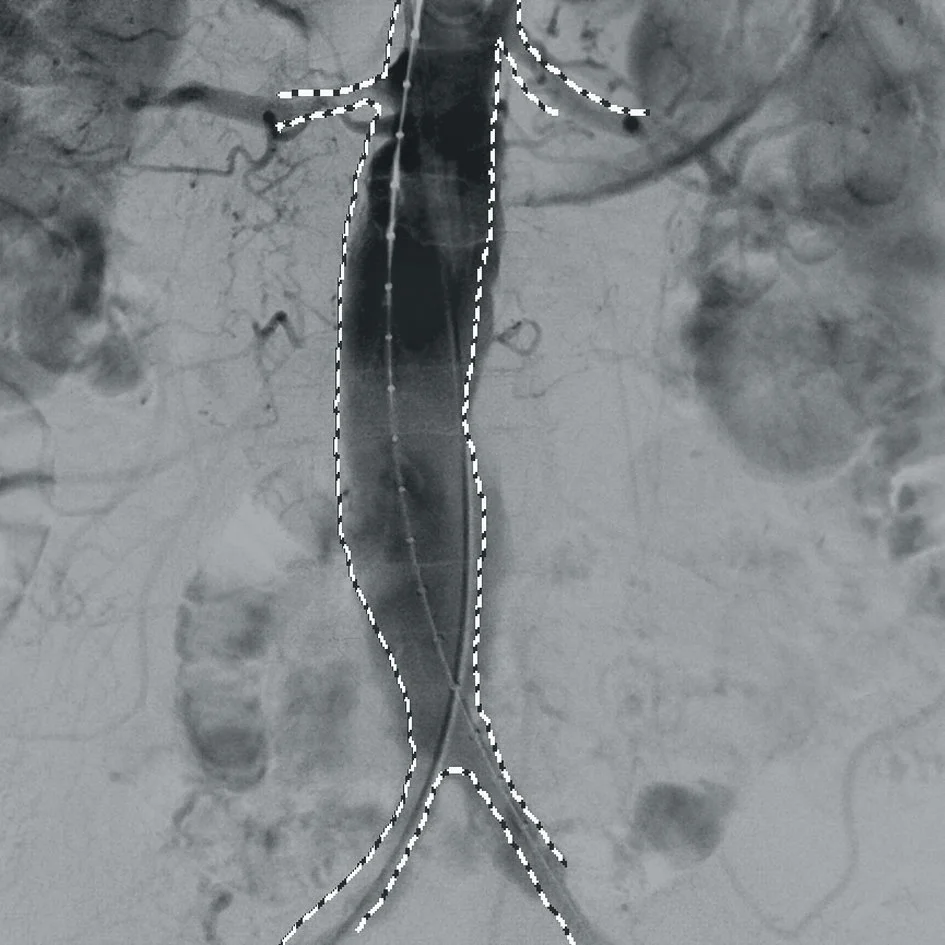 Ziehm Vision RFD Hybrid Edition — Progressive Medical Corp.