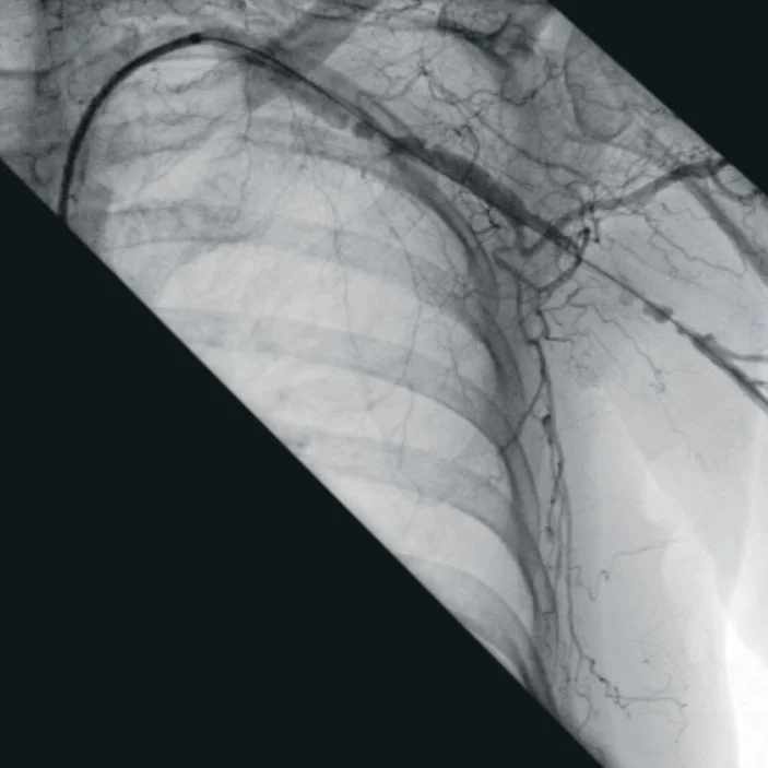 Ziehm Vision RFD Hybrid Edition Cardio — Progressive Medical Corp.