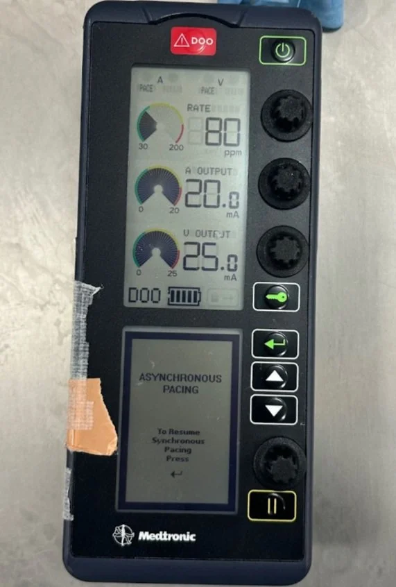 Pick Up the Pace: TVP for the Emergency Physician — NYP Emergency ...