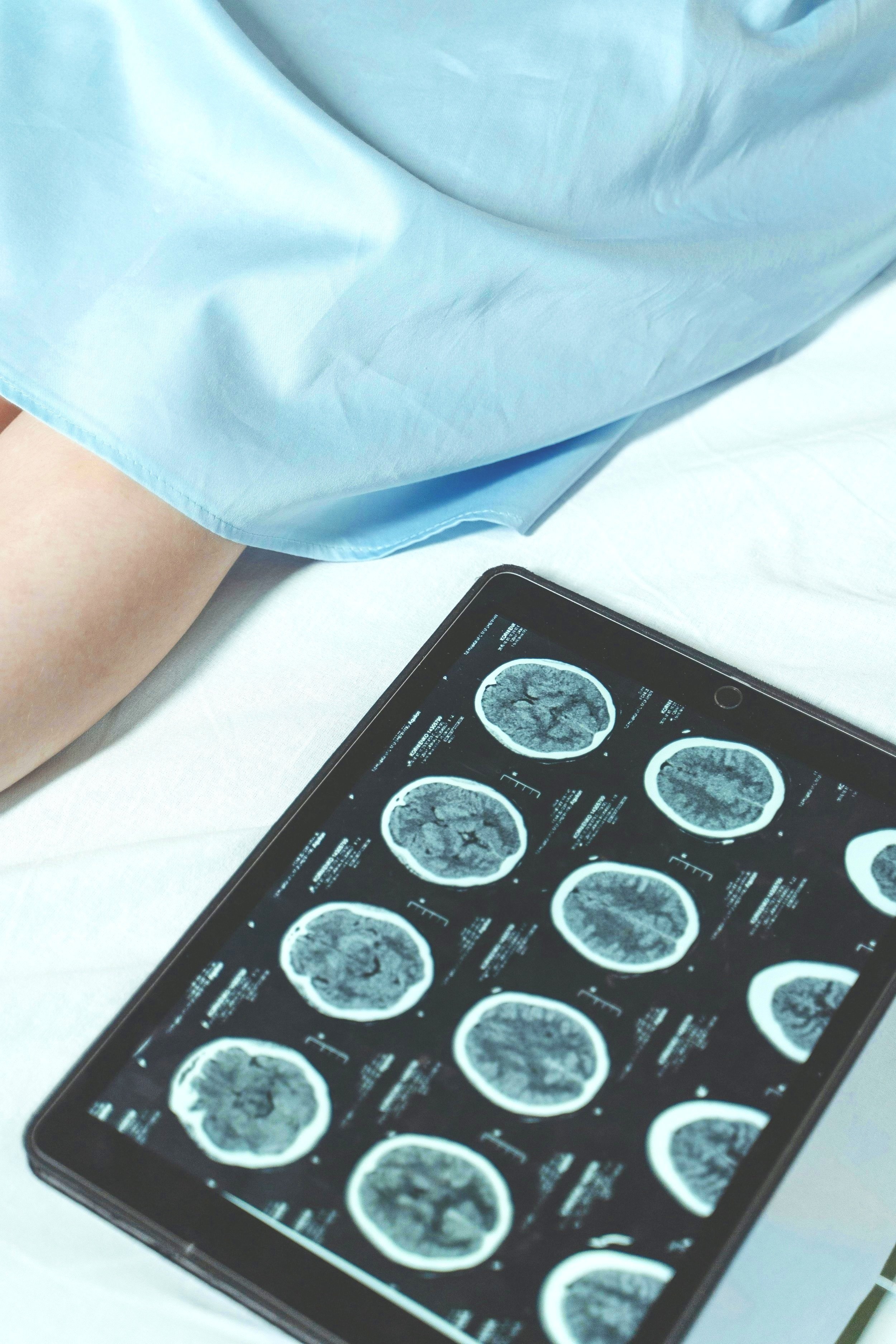 Motor Neurone Disease (MND) — Nursing Station