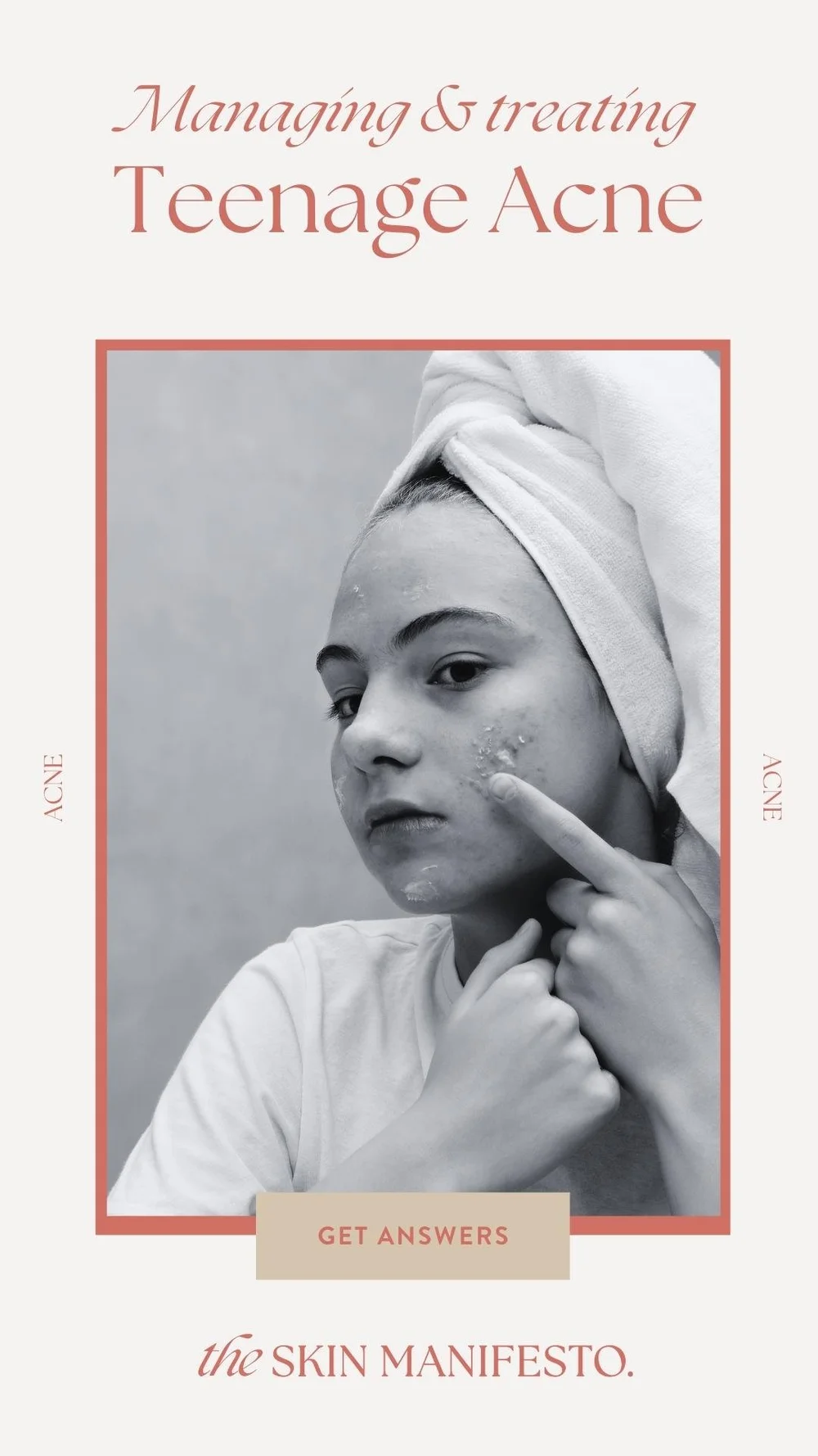 Teenage Acne: Skincare routine to prevent, manage & reduce acne in ...