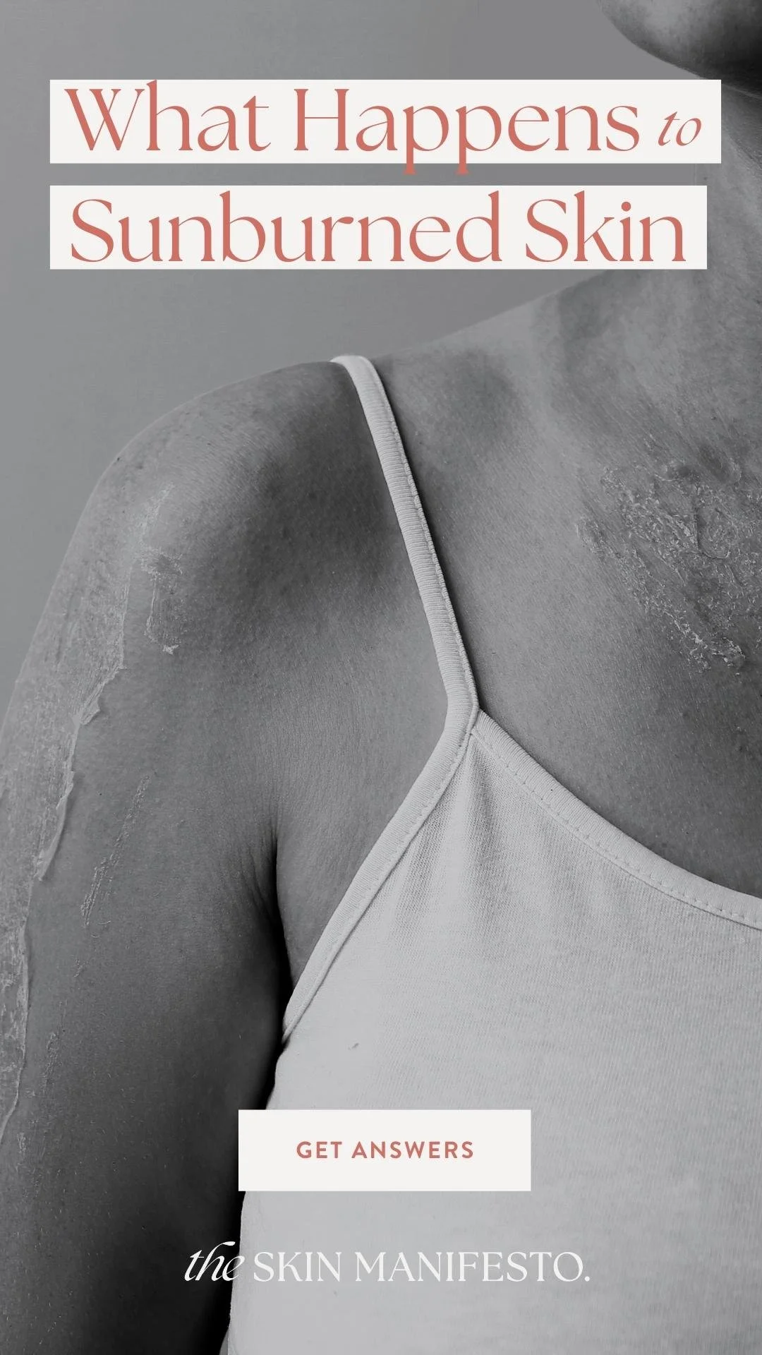 What happens to your skin when it gets sunburned? — The Skin Manifesto