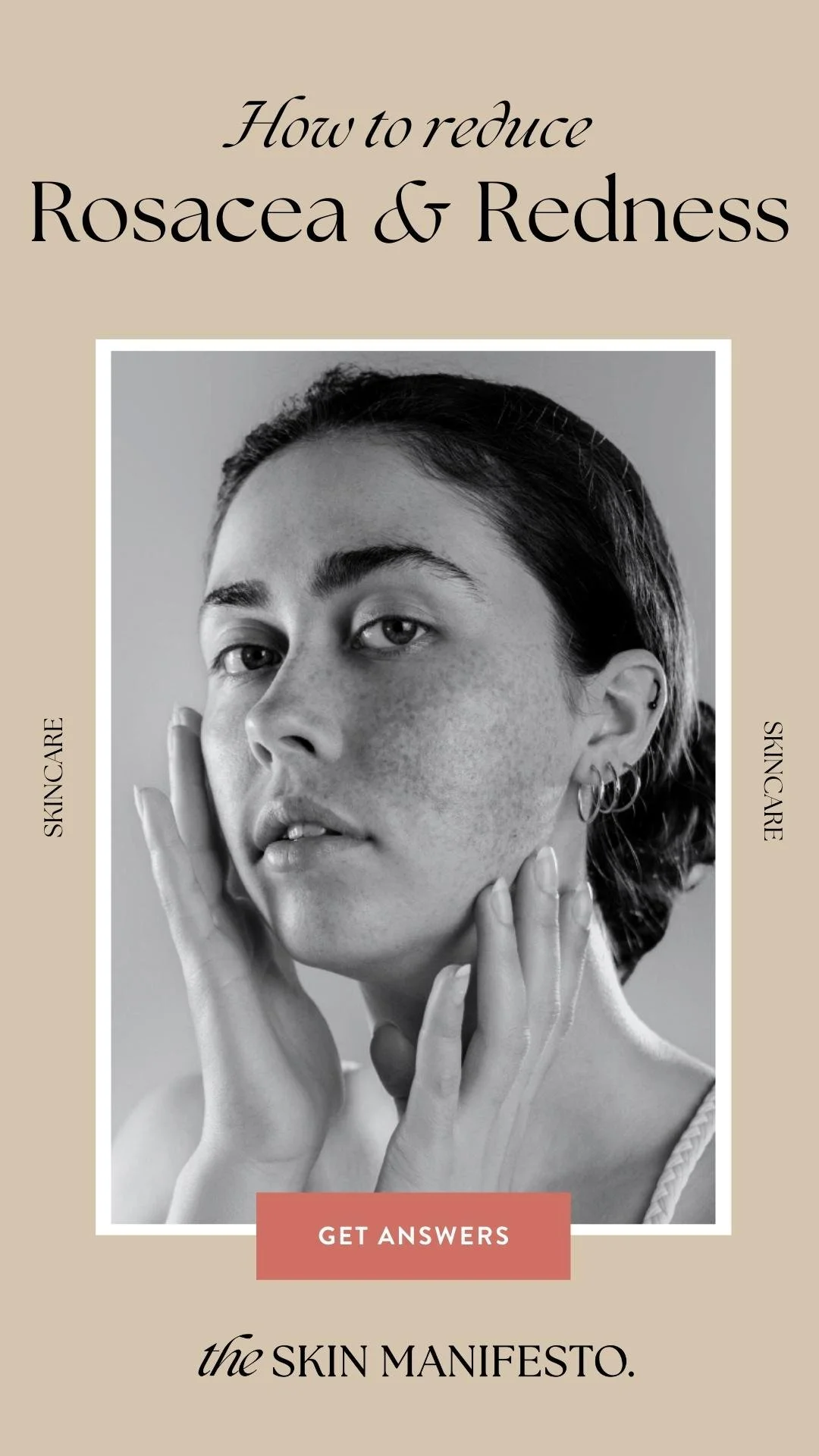 Rosacea treatment: reduce redness of your face — The Skin Manifesto