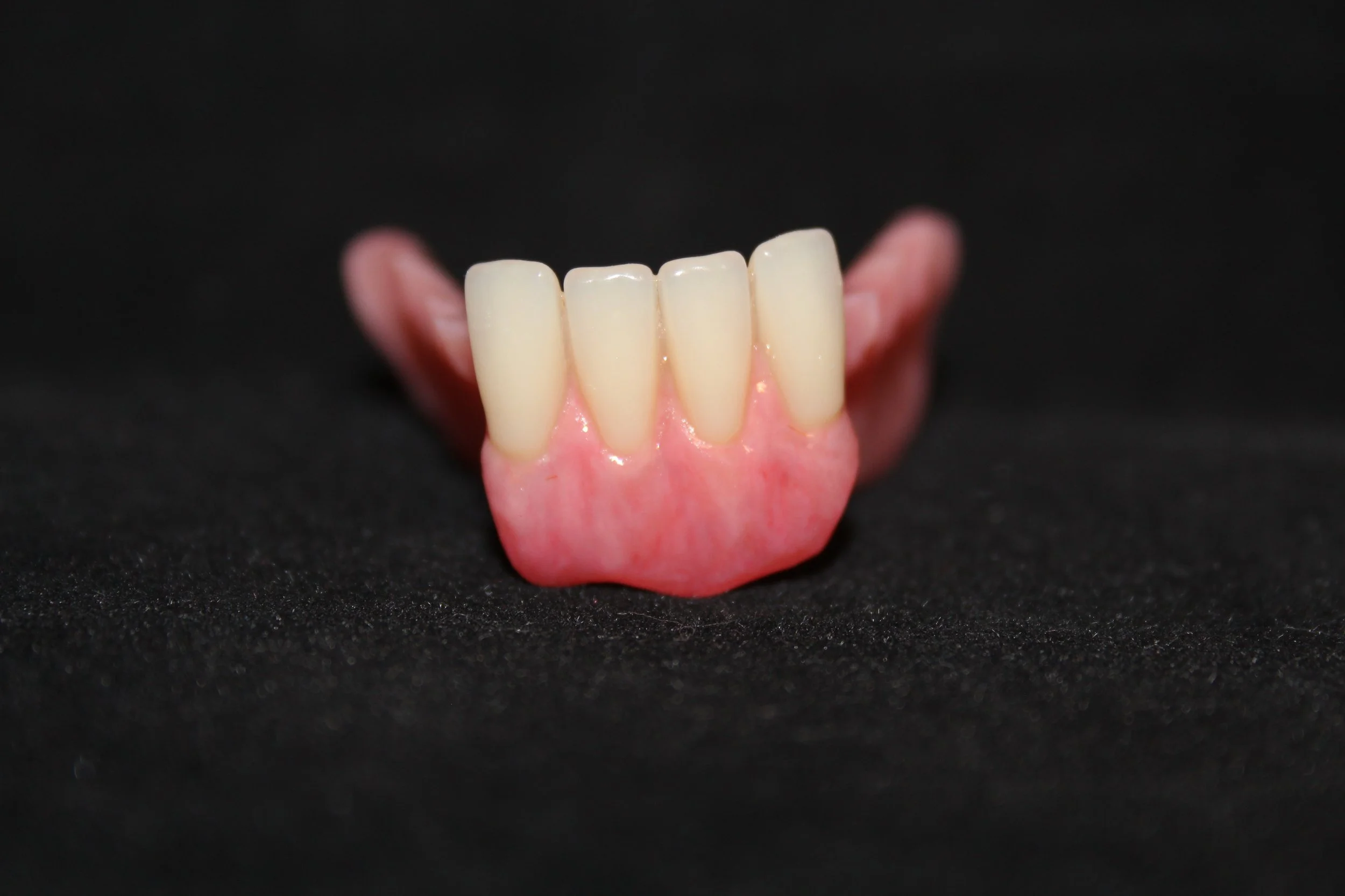 Partial Lower Acrylic Denture — Hampshire Dental Laboratory