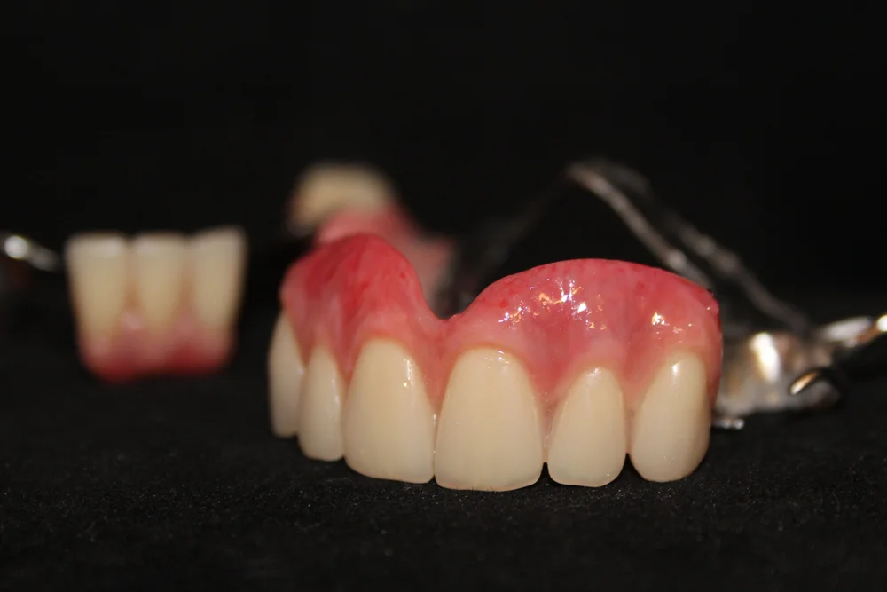 Partial Chrome Denture — Hampshire Dental Laboratory