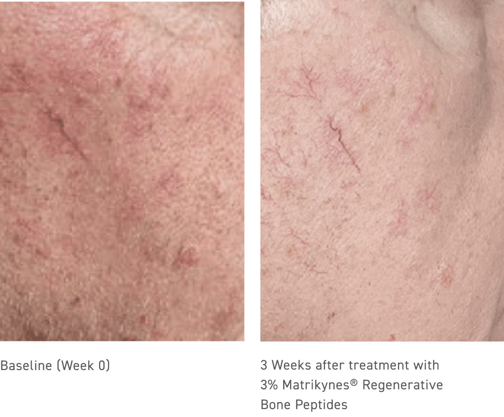 Reparative Oil-Serum Infusion — Sweet Chemistry