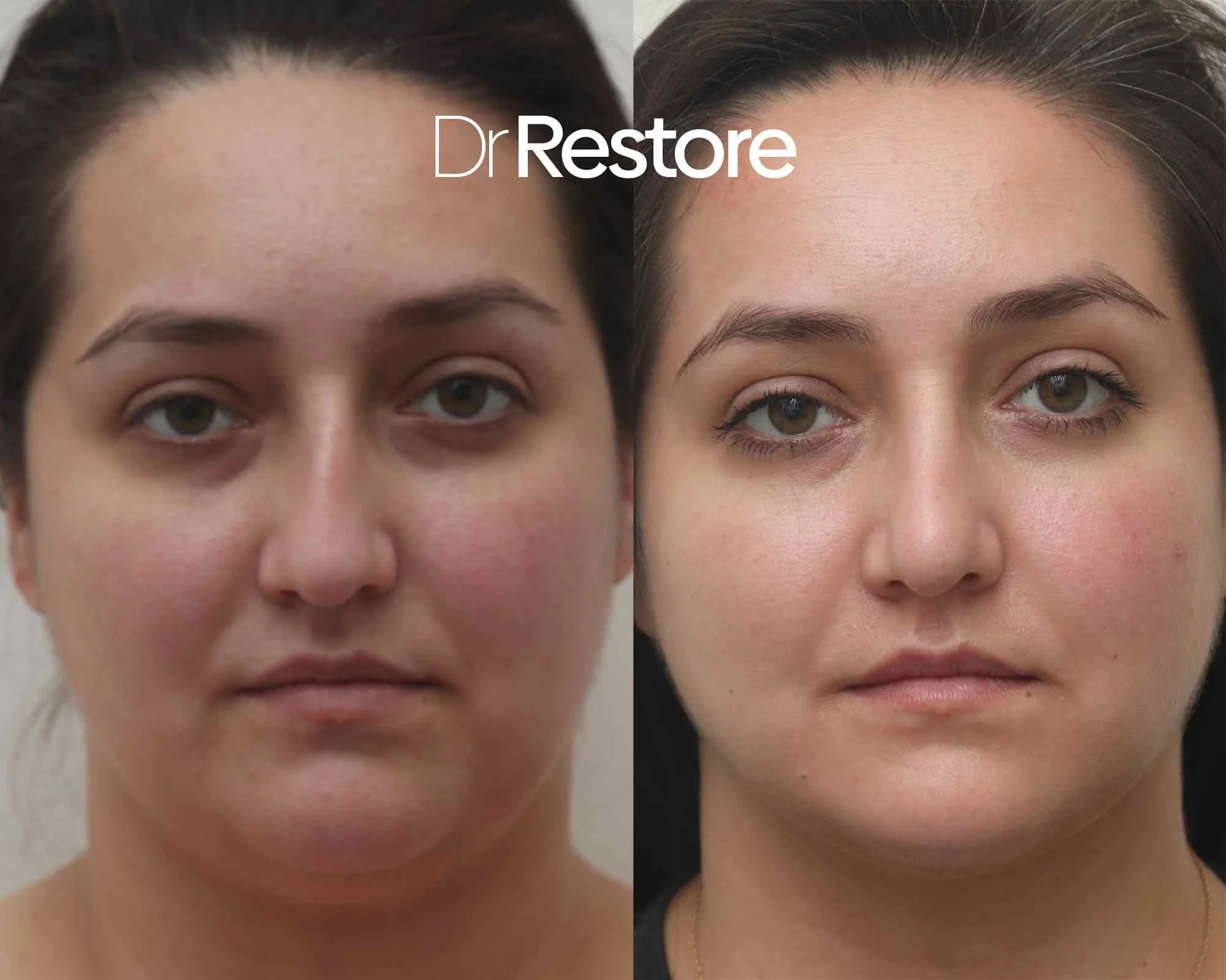 Team 1 — Dr Restore - Curtis Perry MD