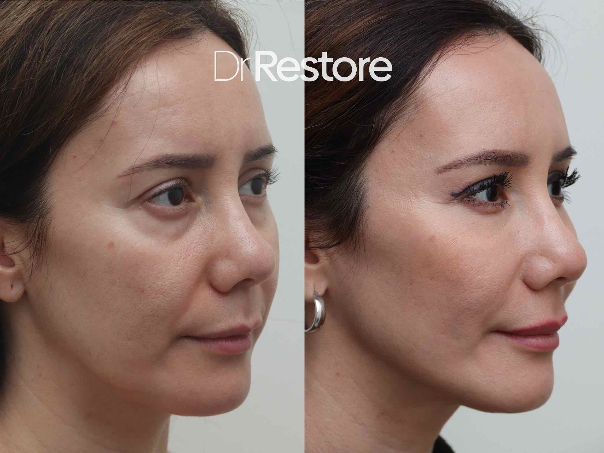 Team 1 — Dr Restore - Curtis Perry MD