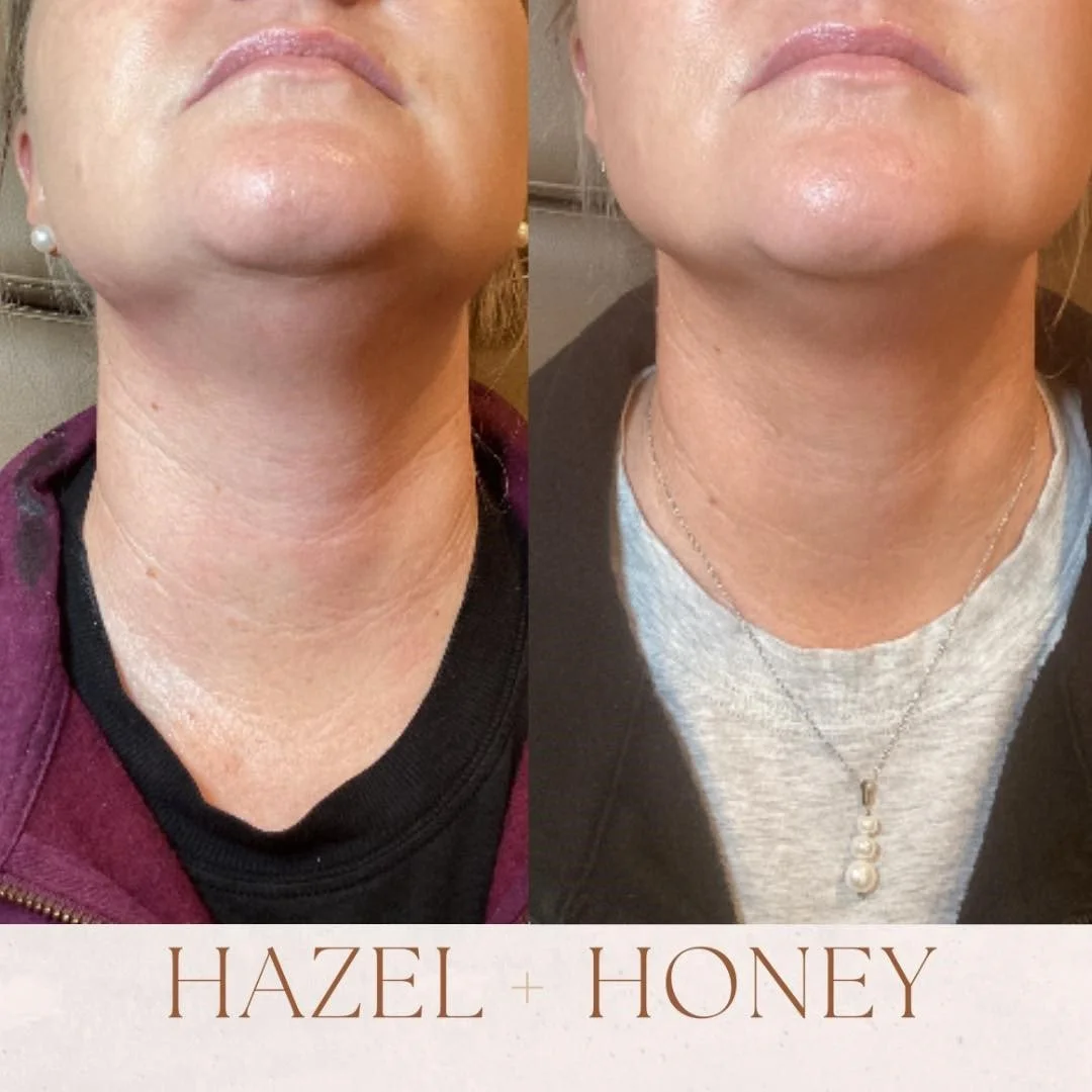 Hazel and Honey Med Spa