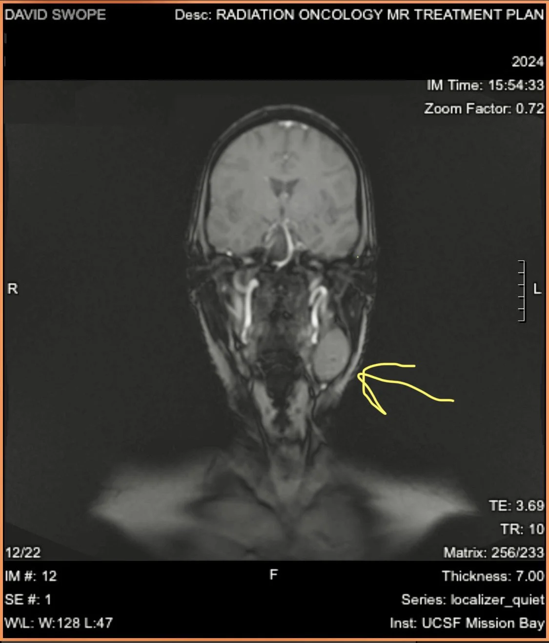 From Cancer to Gratitude: A Journey Through Faith, Survival, and ...