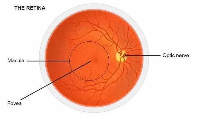 FAQs 2 — Birdshot Uveitis Society of North America