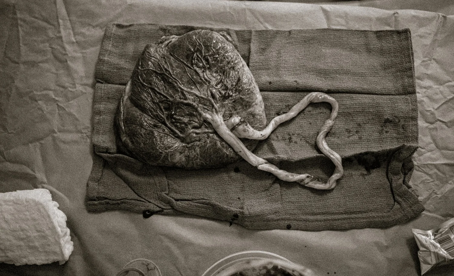 Placenta Encapsulation — Wellspring Birthwork
