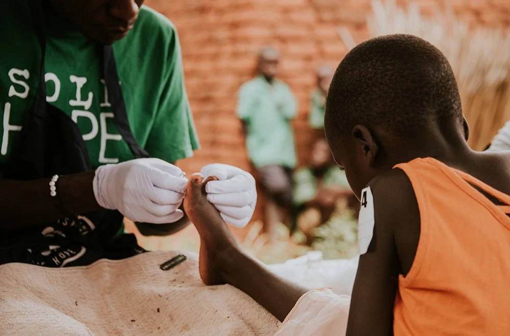 What Are Jiggers? The Parasite Behind the Pain and How Sole Hope Is ...