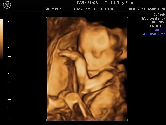 3D/4D Ultrasound Session — Tiny Beats 3D Ultrasound