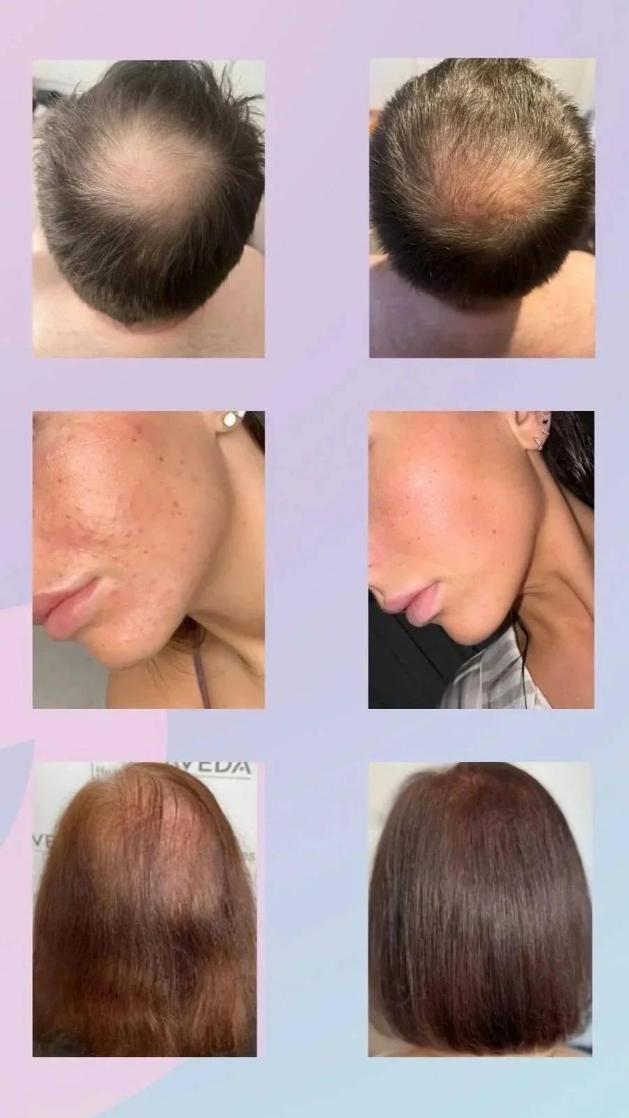 URBANGREEN x GLOWWA HAIR FOOD — URBAN GREEN Aveda Hair Salon & Barber ...