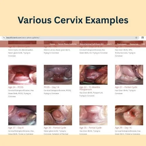 How to See Your Own Cervix: A Step-by-Step Visual Guide — Visit Fertility