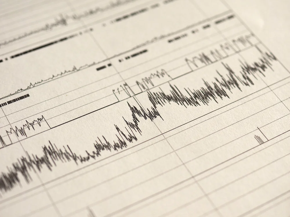 Comprehensive Sleep Study — Sleep Medicine Clinic