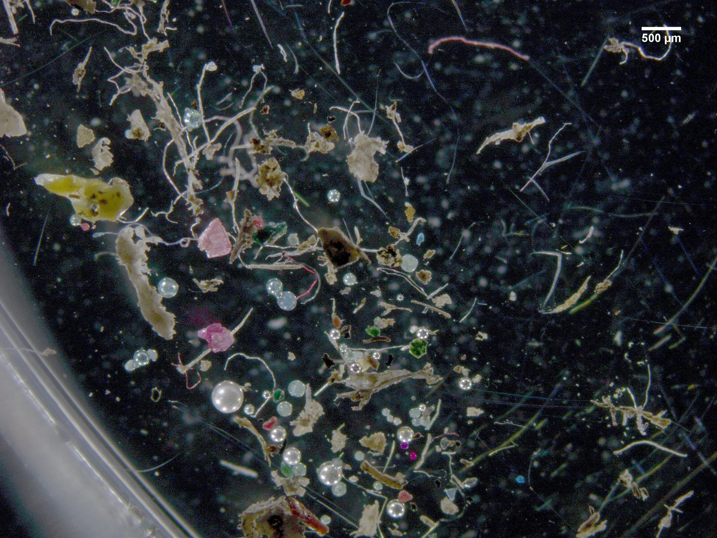 MICROPLASTICS: Professor Says Illegal Sewage Dumping Is Filling UK ...