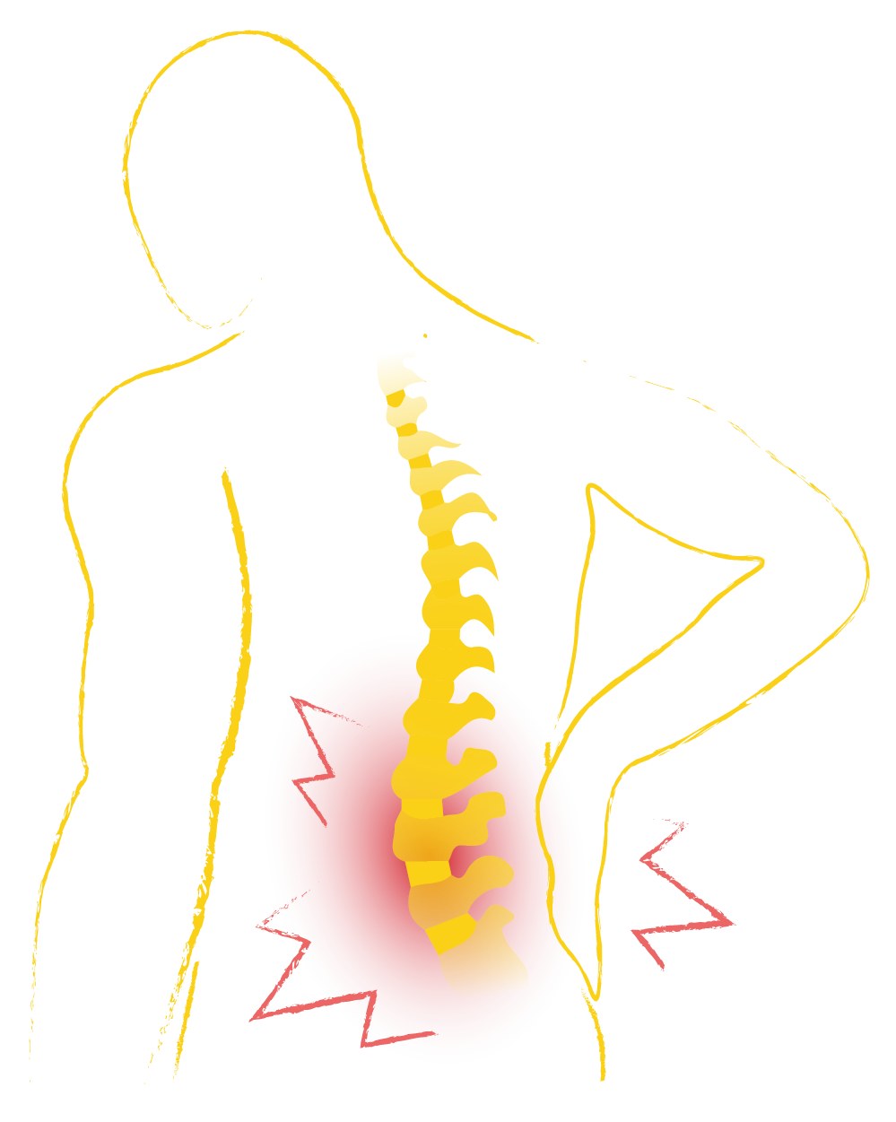 Chronic Musculoskeletal Pain: Treatment Challenges and Solutions — Back ...