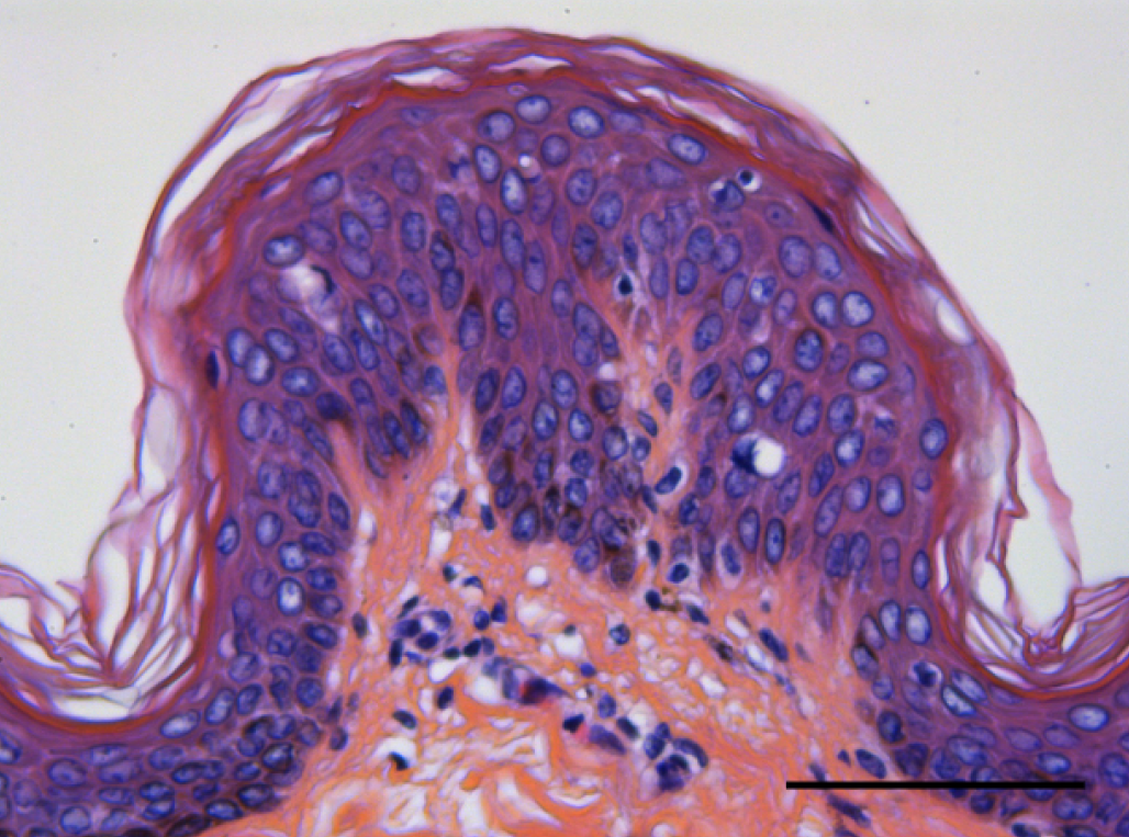 Scinai Announces Promising Results in a Psoriatic Human Skin Model — Scinai