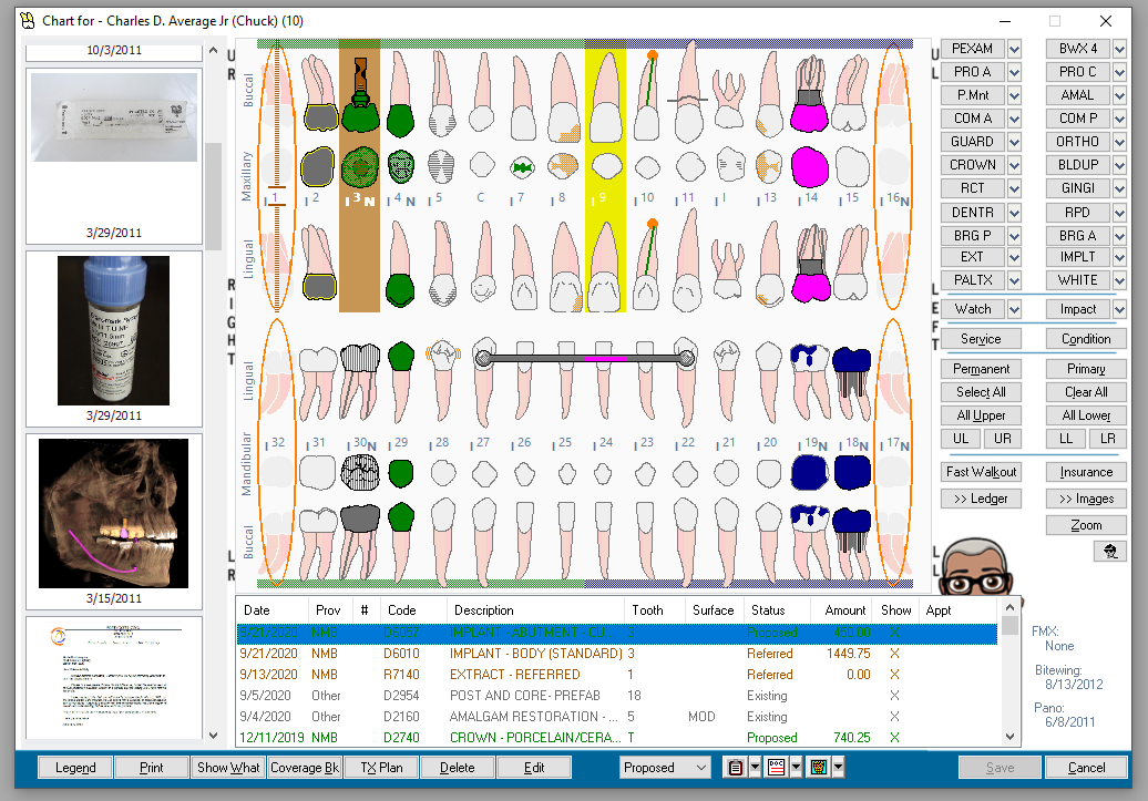 How Andre Attaches Images To The Chart In Eaglesoft — The Crew Process