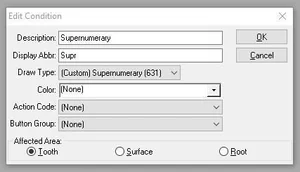 Andre's Supernumerary Tooth Charting and Billing in Eaglesoft — THE ...
