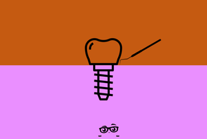Andre Creates a way to Perio Chart an Implant in Eaglesoft when a Tooth ...