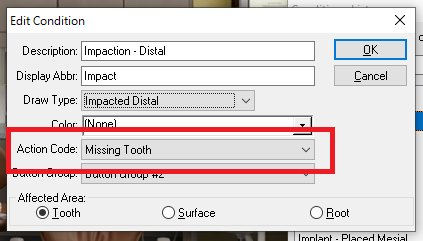Are Your Impactions Showing Up in Your Perio Chart? Andre Shows You How ...