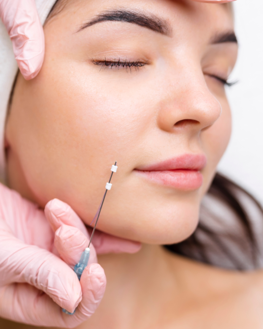 Collagen Smooth Threads — V Sculpt Aesthetics