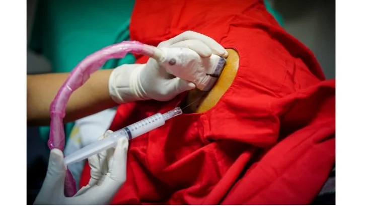 Shoulder Pain Explained: Differentiating Joint, Rotator Cuff, and ...