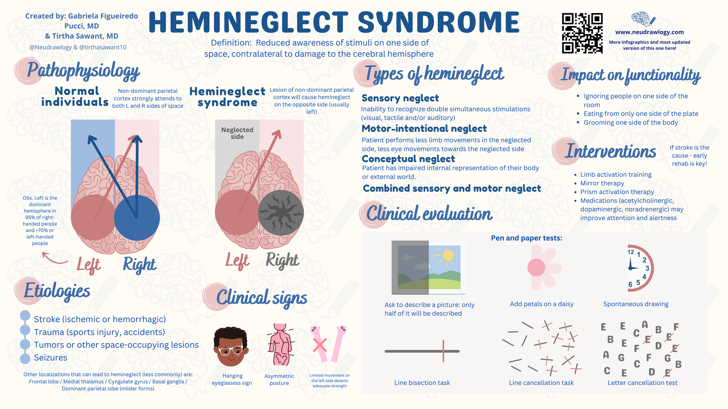 Hemineglect Syndrome Neudrawlogy Simplifying Neurology