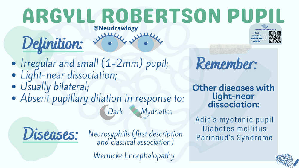 Argyll Robertson pupil — Neudrawlogy: Simplifying Neurology