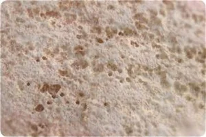 OSSIOfiber - Naturally Transformative Bone Healing — Premier Bone ...