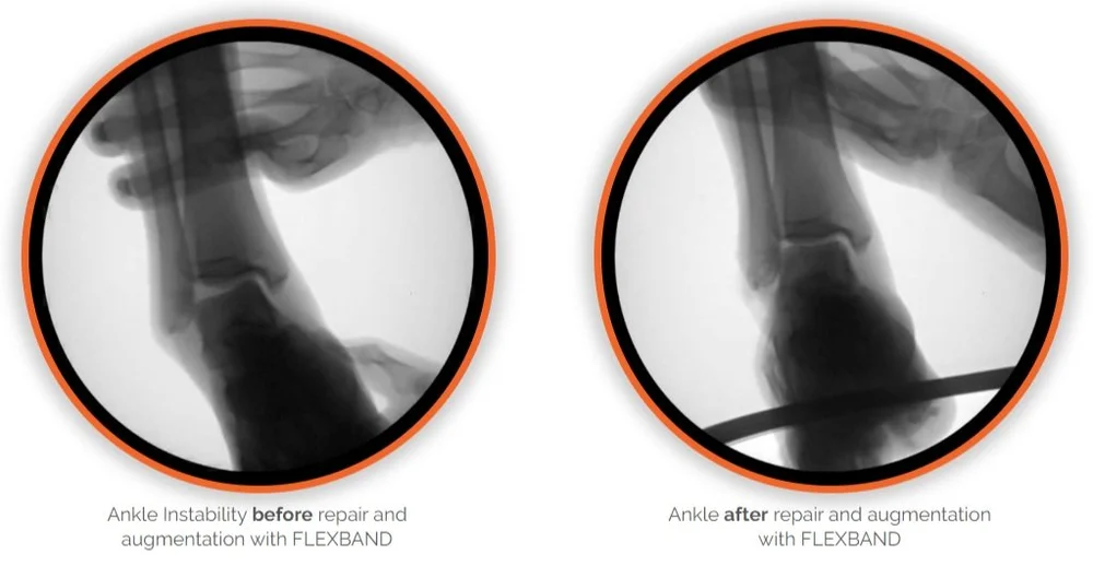 Dr. Gueramy Adult Foot & Ankle Reconstruction — Premier Bone & Joint ...