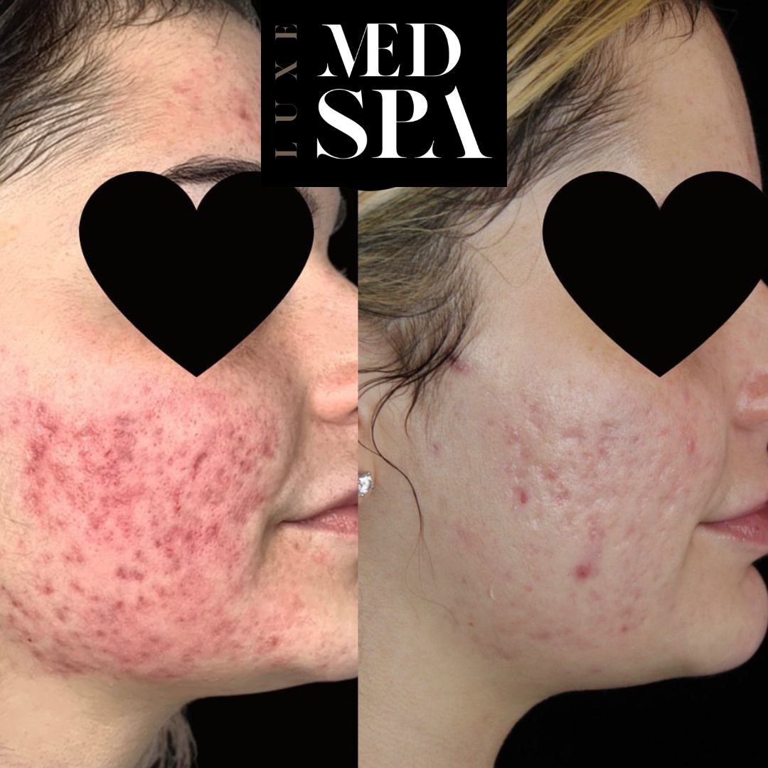 Luxe Med Spa Aesthetics