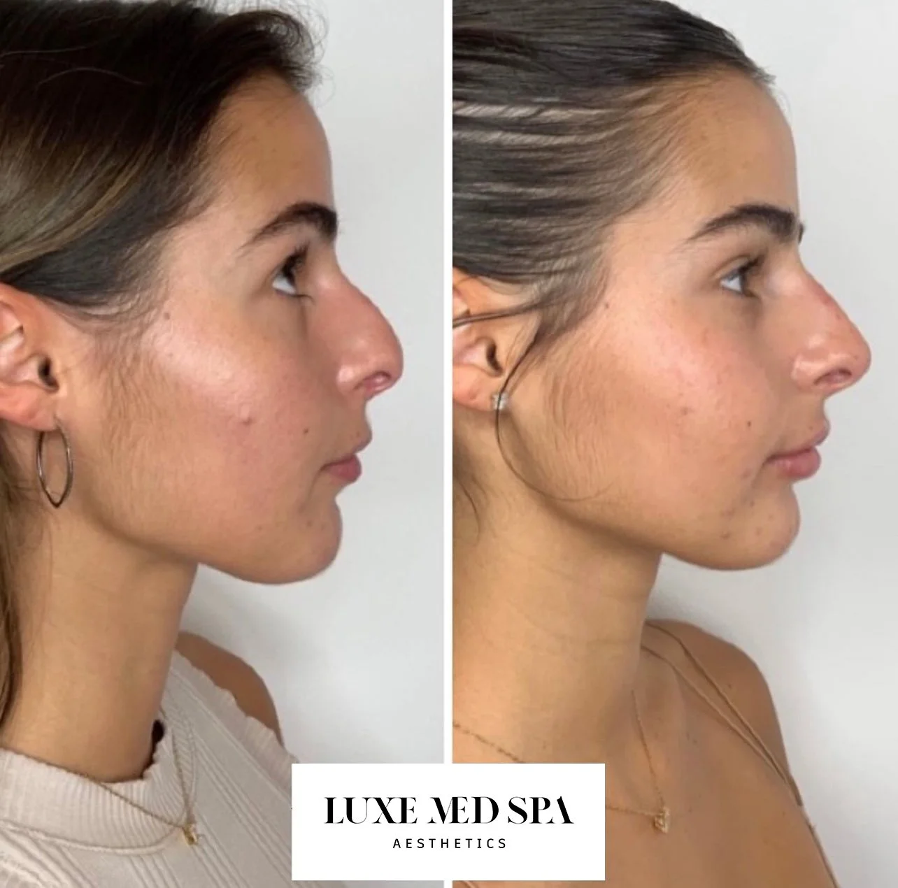 The Science Of Beauty: Unveiling Innovative Aesthetic Injectable ...